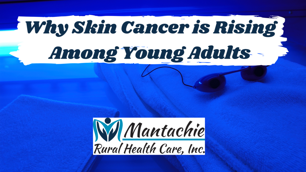 Why Skin Cancer is Rising Among Young Adults - Mantachie Rural Health ...